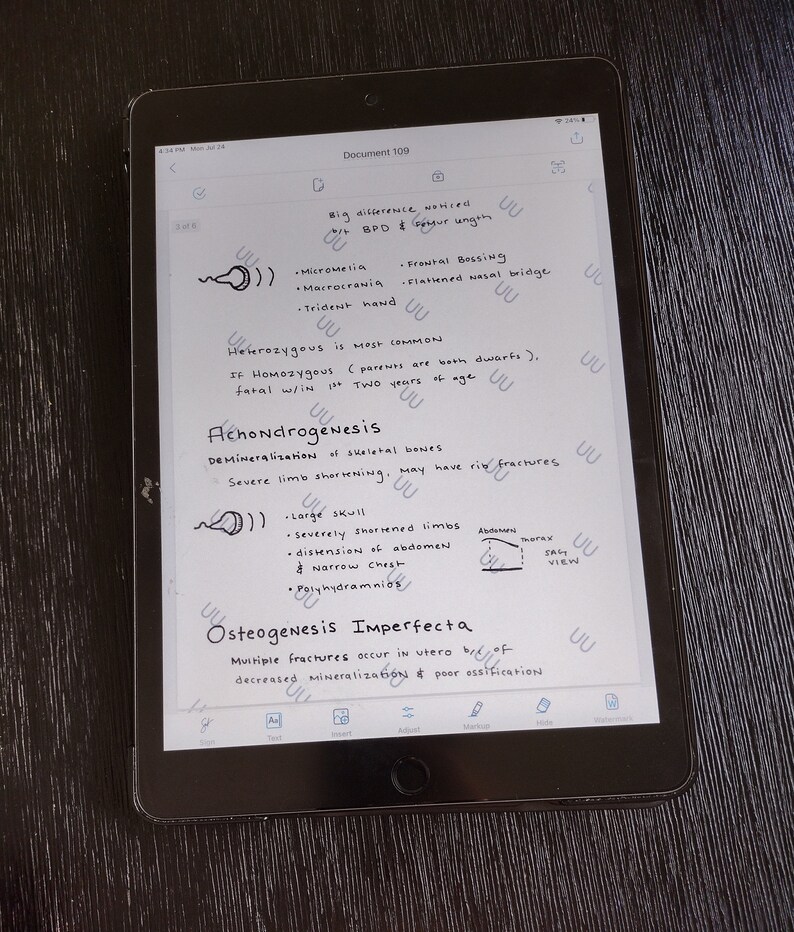 Sonography Visual Study Notes: Fetal Spine and Musculoskeletal ...