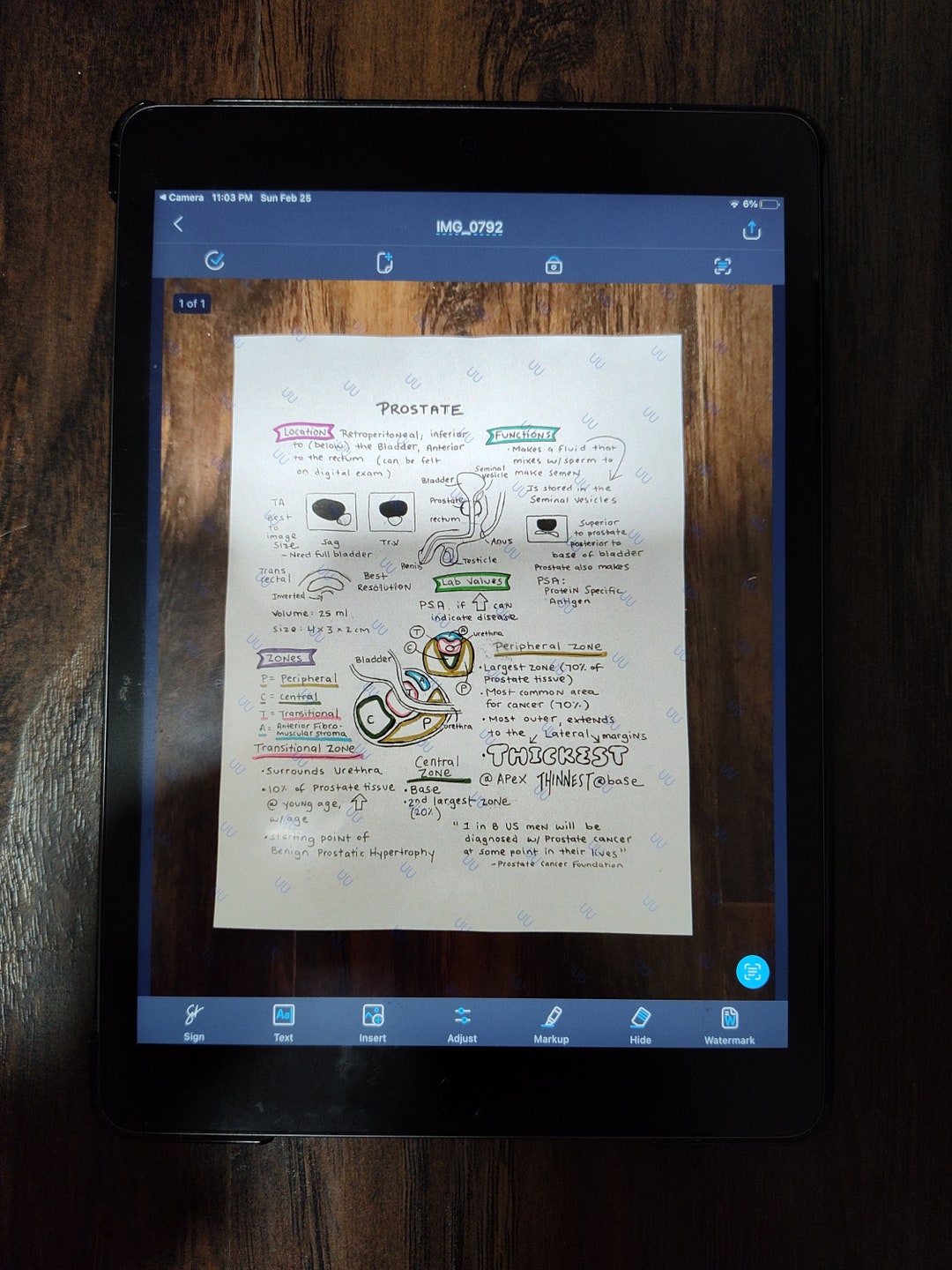 Prostate Ultrasound Visual Reference (with Color) - Etsy