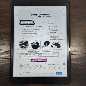 Breast Ultrasound Cysts: A Visual Reference - Etsy