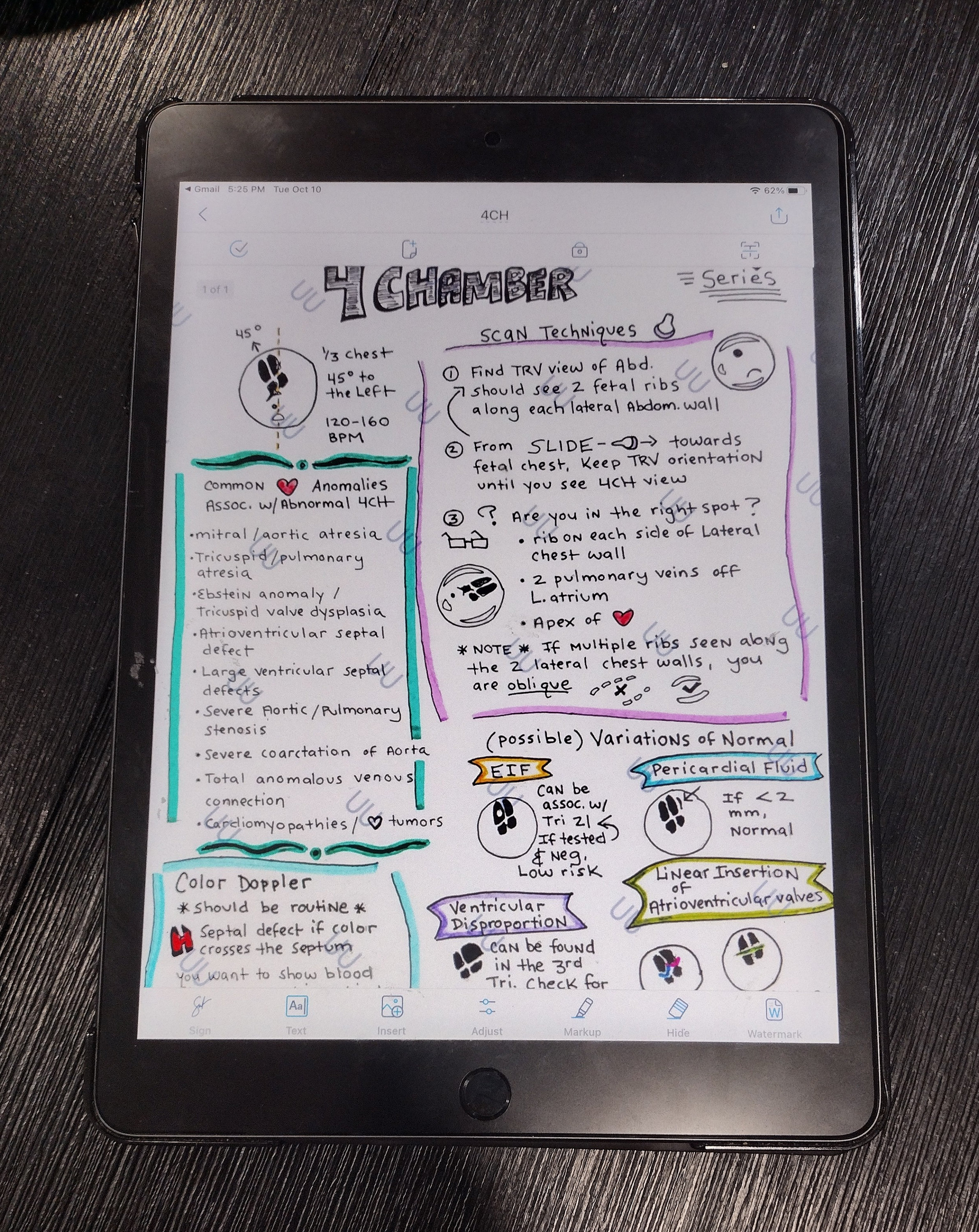 Fetal Heart Bundle: Ultrasound Visual Reference (includes Overview, 4ch ...