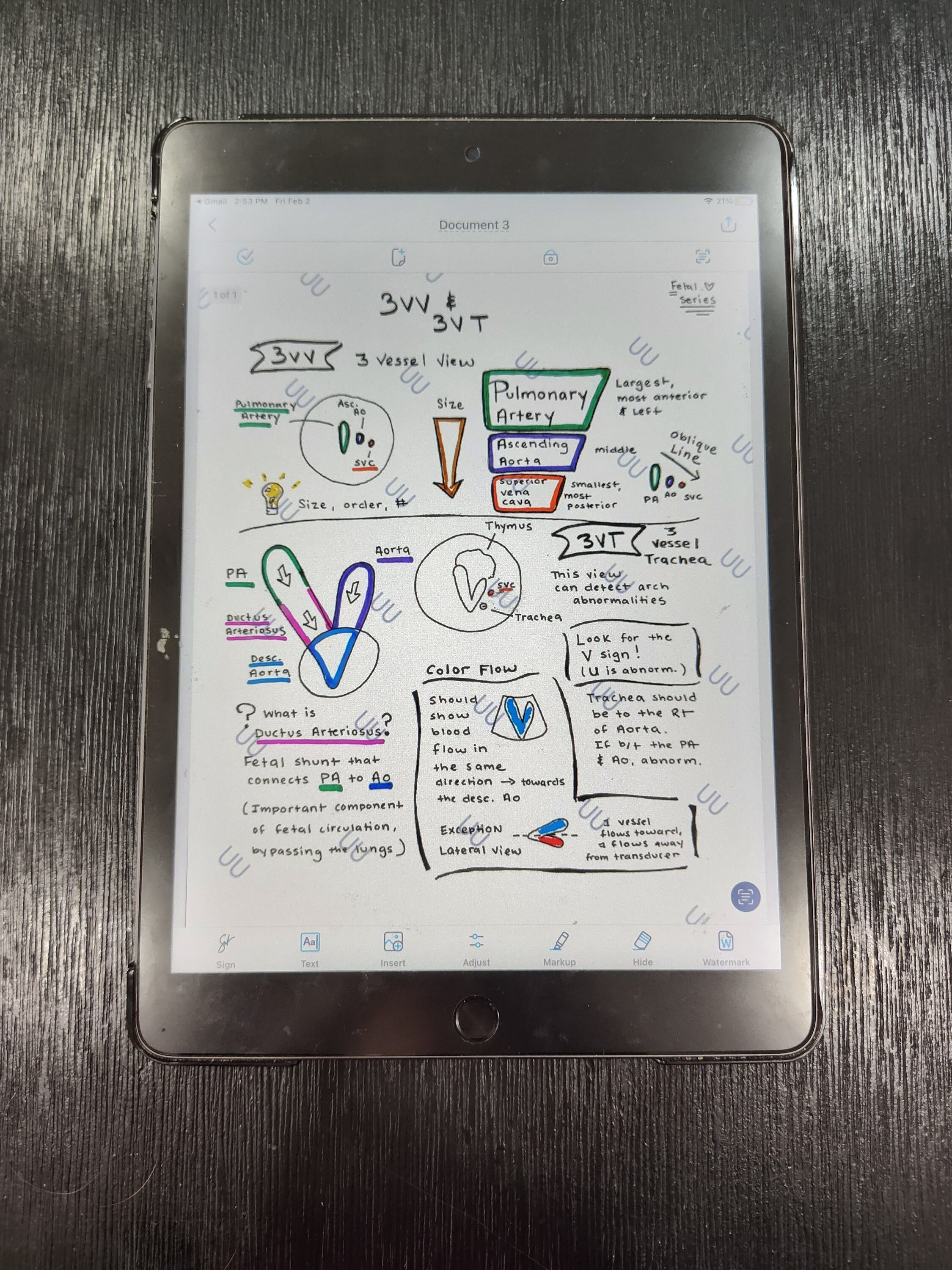 Fetal Heart Bundle: Ultrasound Visual Reference (includes Overview, 4ch ...