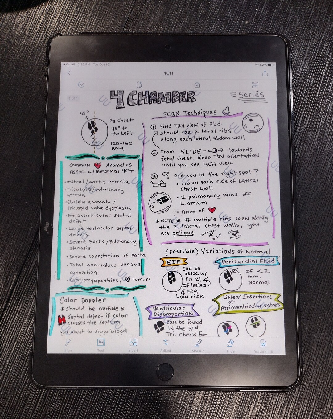 4 Chamber Fetal Heart Ultrasound / Sonography Visual Study Notes - Etsy