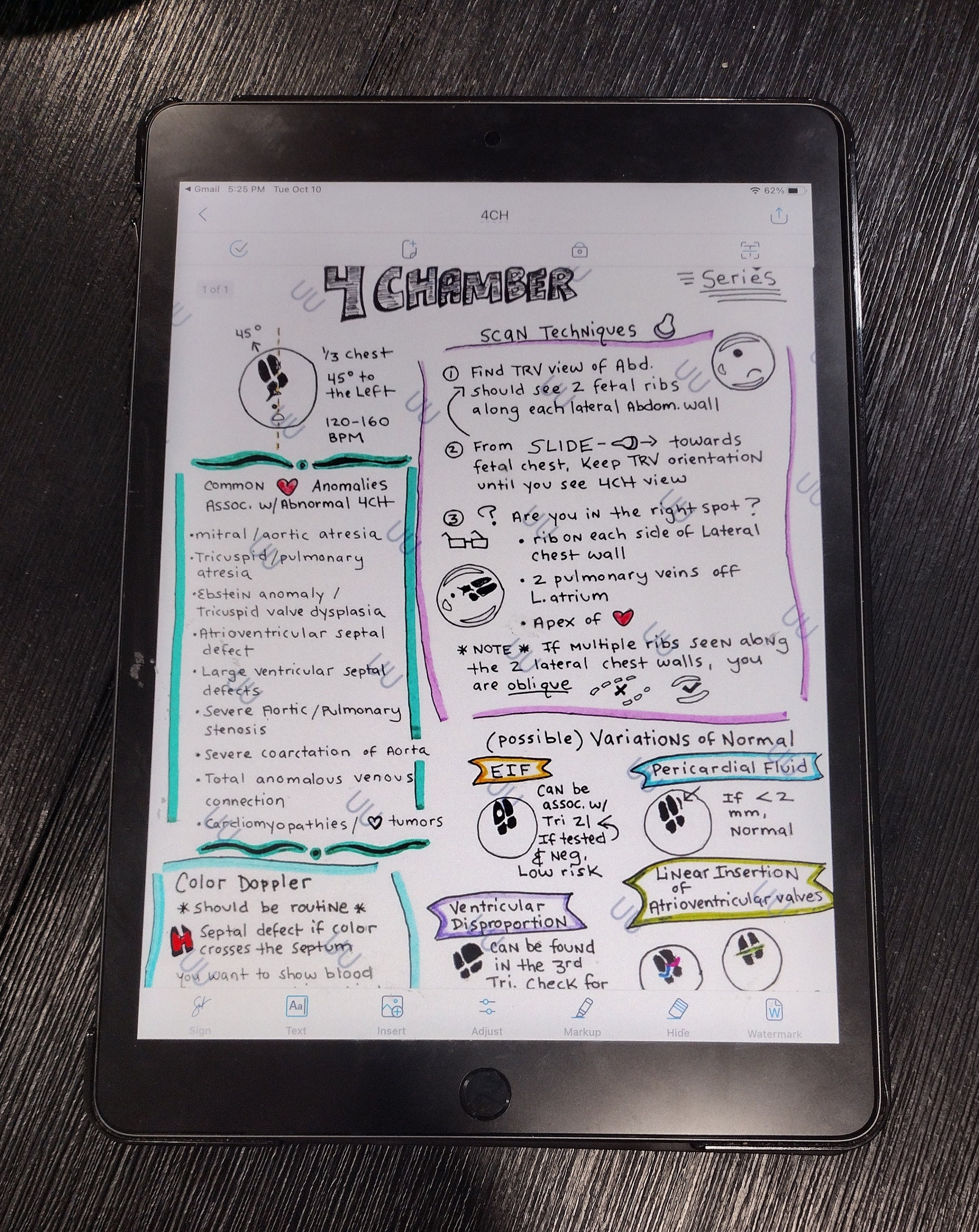 4 Chamber Fetal Heart Ultrasound / Sonography Visual Study Notes - Etsy