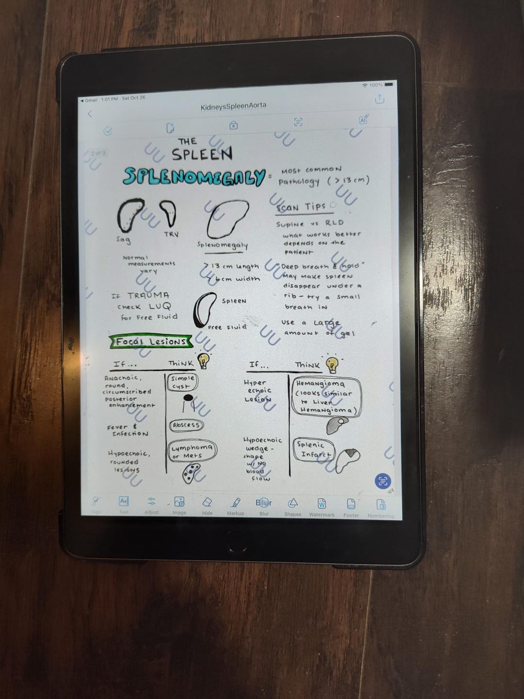 SPLEEN Sonography / Ultrasound Visual Reference Study Notes - Etsy