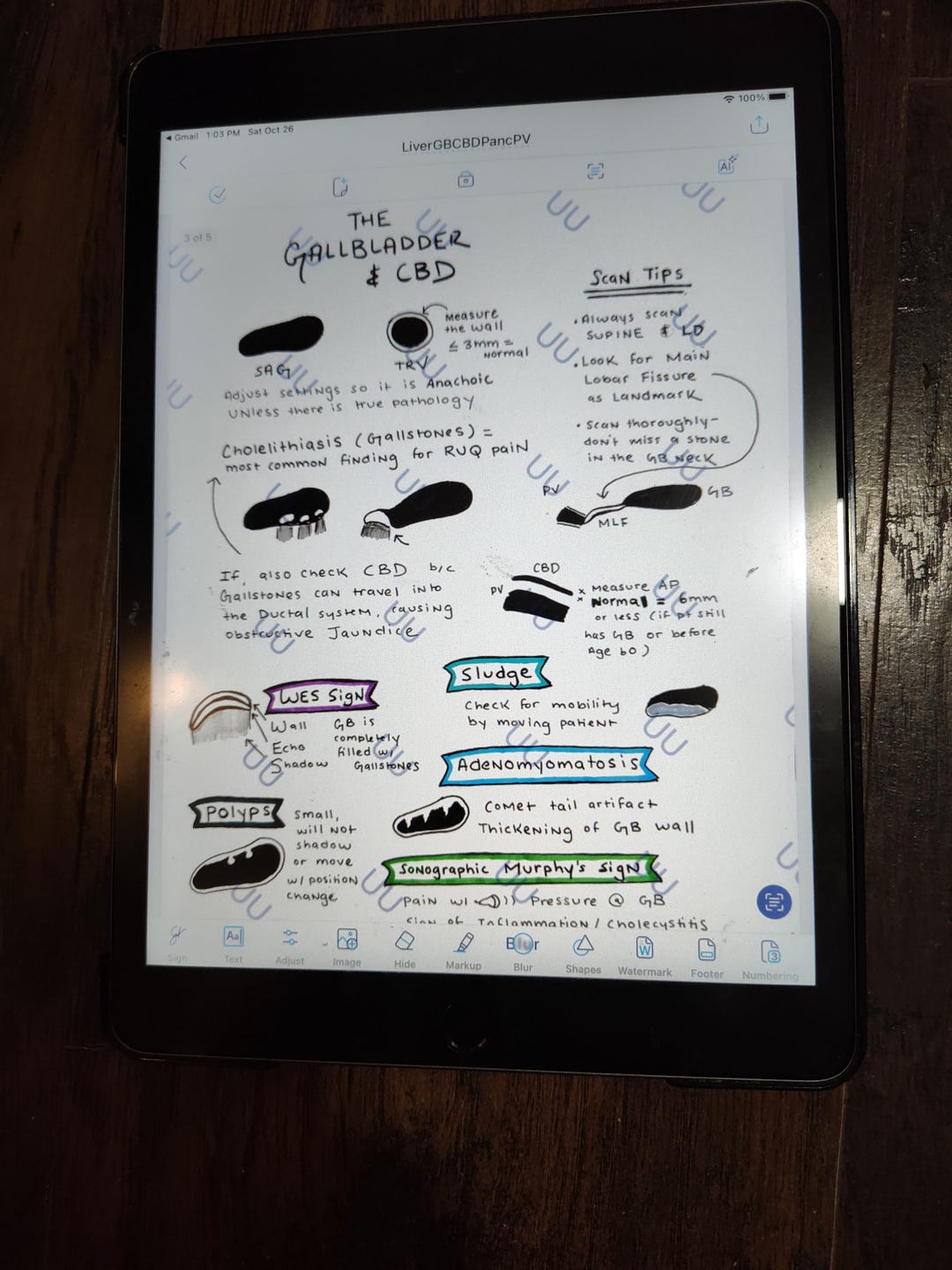The GALLBLADDER & CBD: Sonography / Ultrasound Visual Reference Study ...
