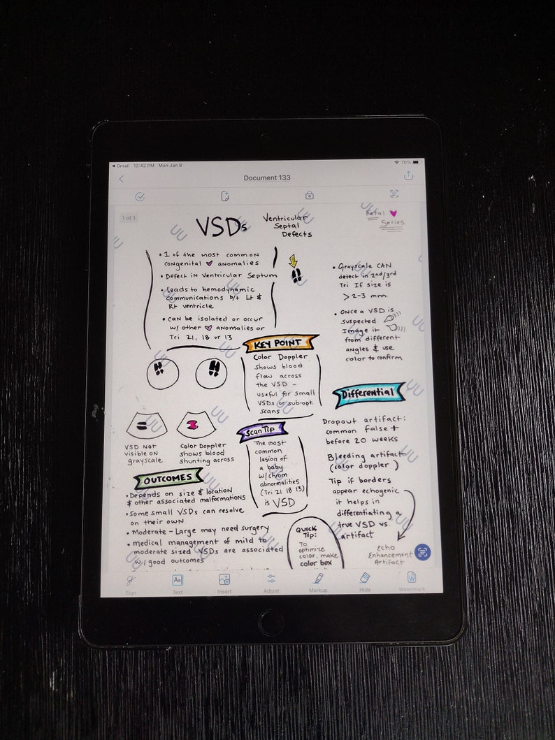 Fetal Heart Ultrasound: Ventricular Septal Defects - Etsy