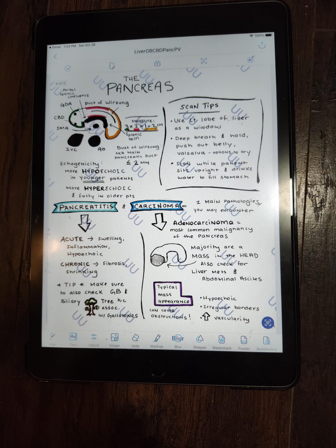 PANCREAS Sonography / Ultrasound Visual Reference Study Notes - Etsy