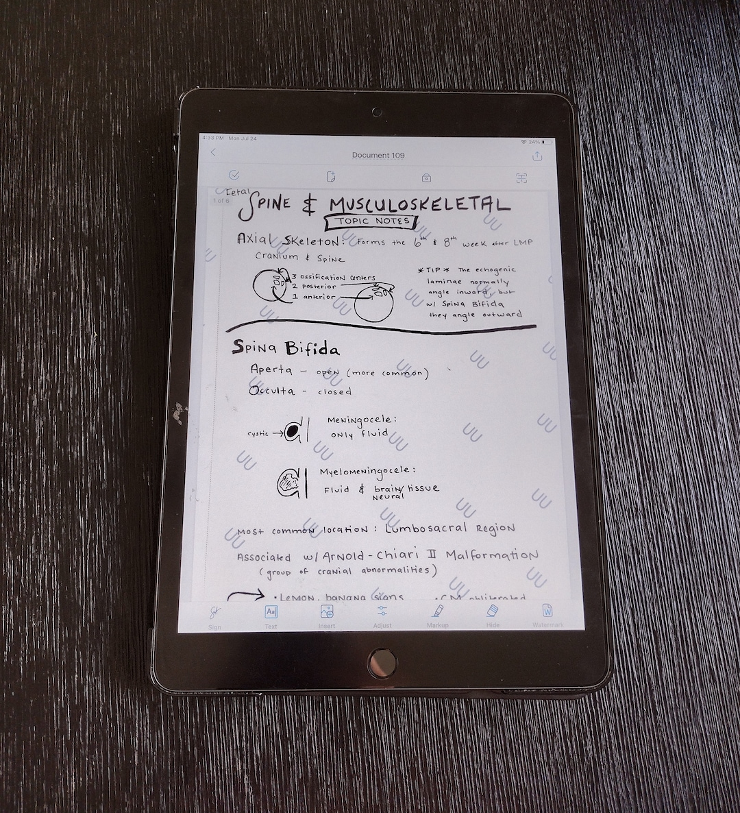 Sonography Visual Study Notes: Fetal Spine and Musculoskeletal ...
