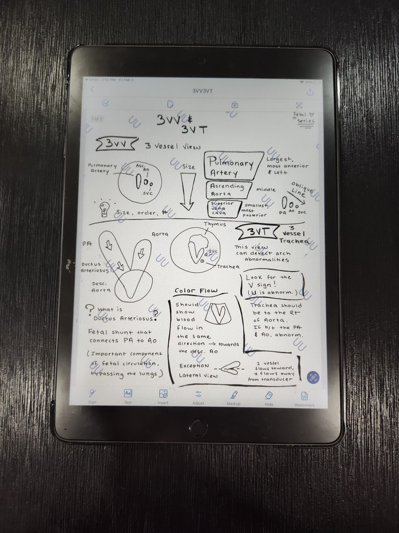 Fetal Heart Ultrasound Visual Reference: 3VV & 3VT (black and White) - Etsy