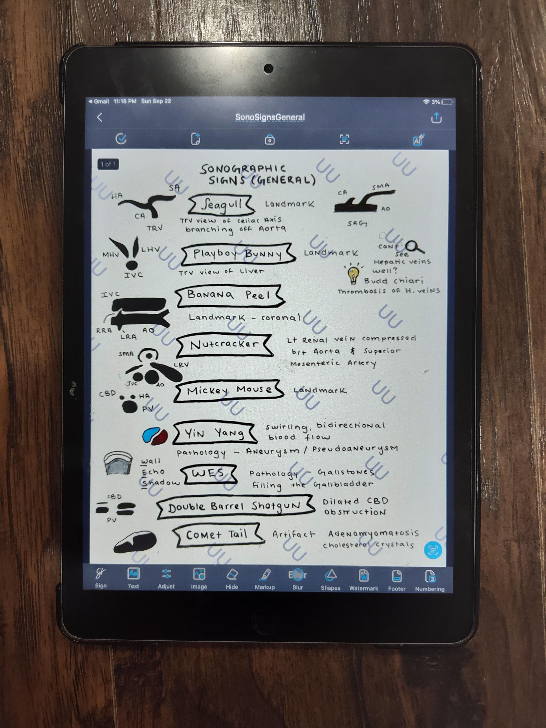 Sonographic Signs (general Ultrasound) Visual Reference - Etsy