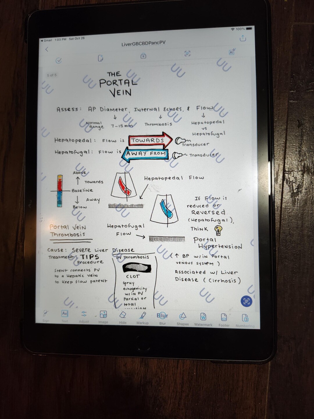 PORTAL VEIN Sonography / Ultrasound Visual Reference Study Notes - Etsy