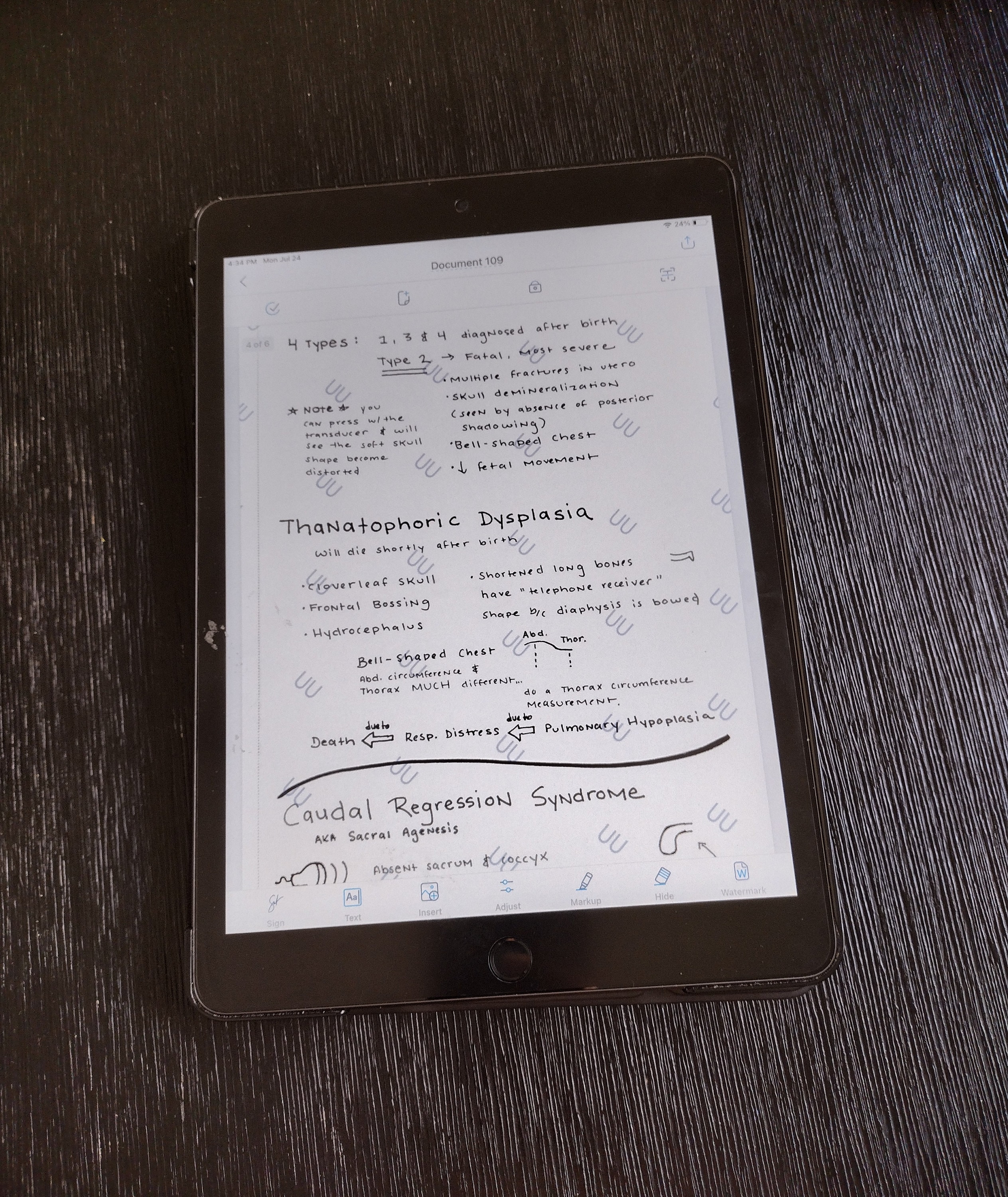 Sonography Visual Study Notes: Fetal Spine and Musculoskeletal ...