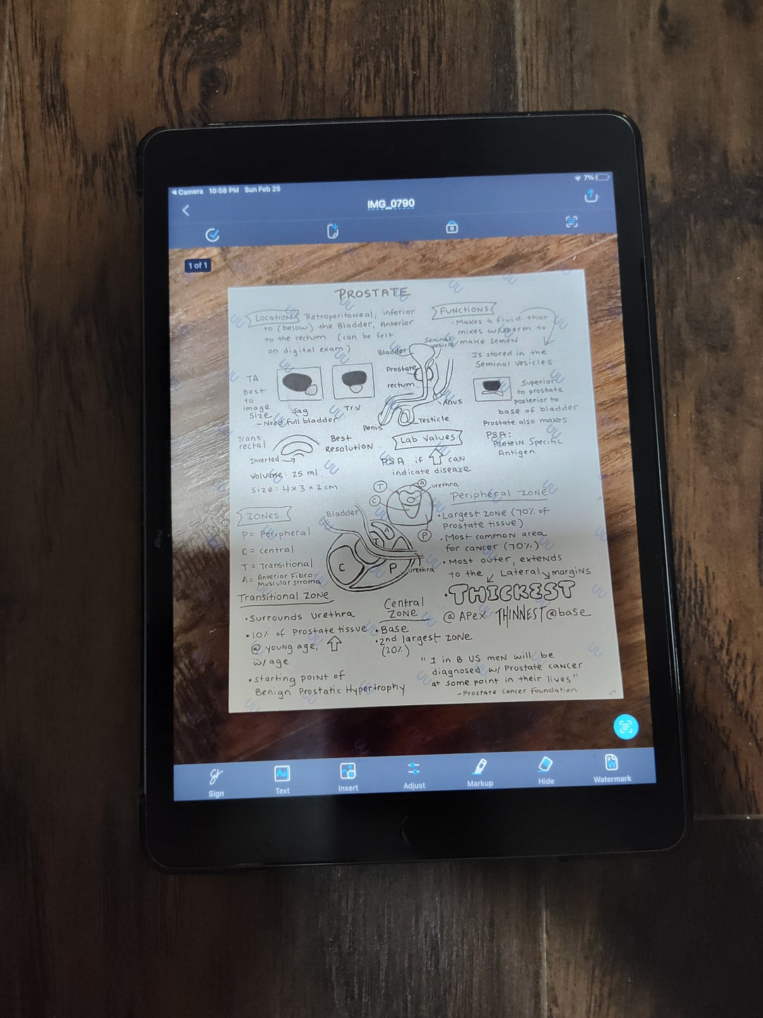 Prostate Ultrasound Visual Reference - Etsy