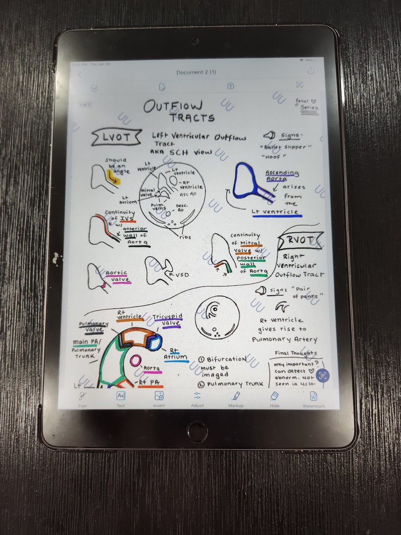 Fetal Heart Bundle: Ultrasound Visual Reference (includes Overview, 4ch ...