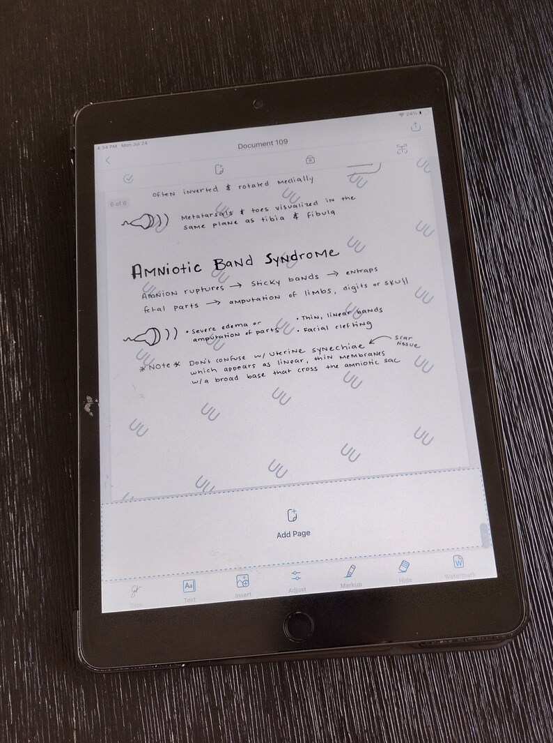 Sonography Visual Study Notes: Fetal Spine and Musculoskeletal ...