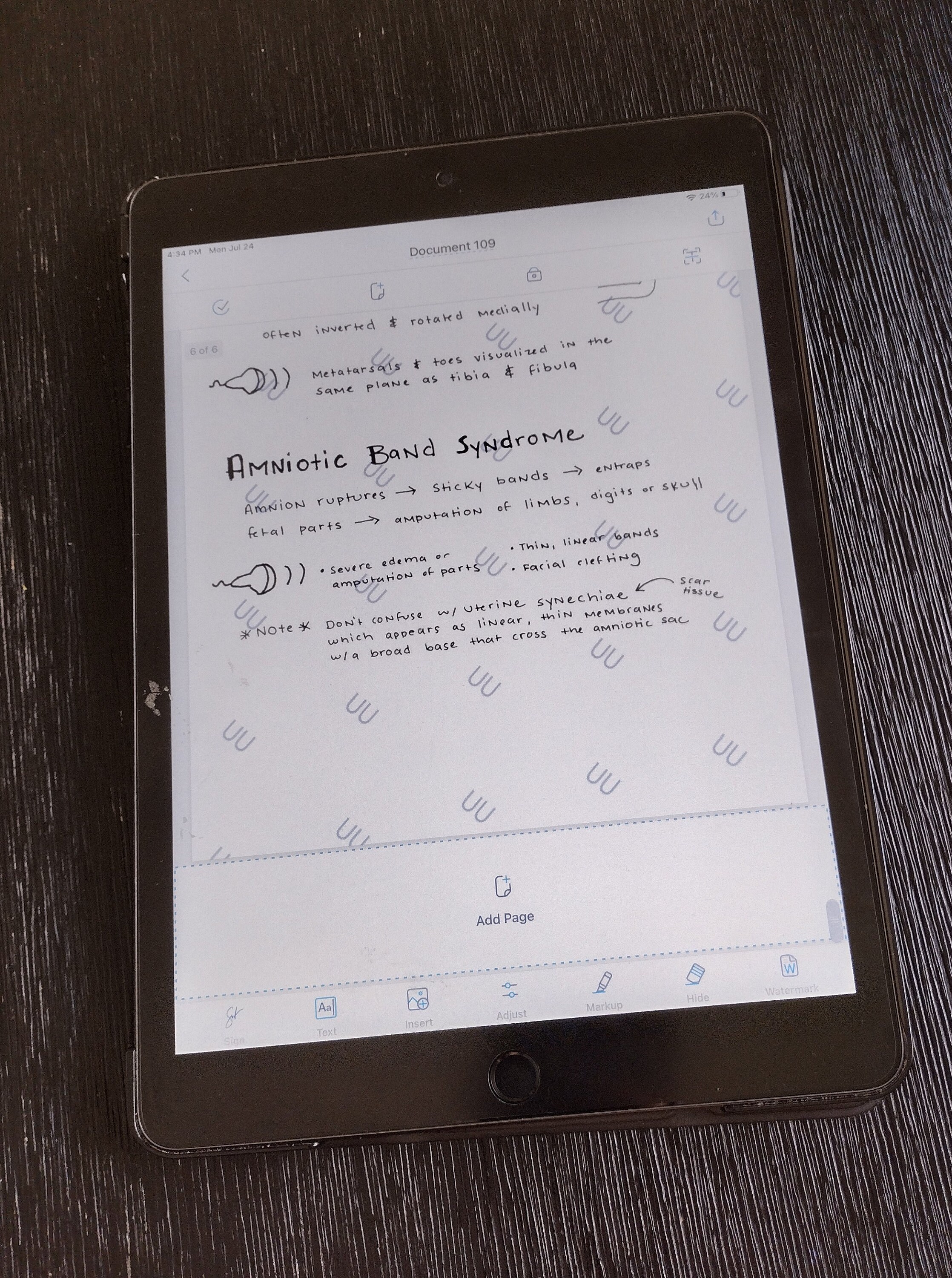 Sonography Visual Study Notes: Fetal Spine and Musculoskeletal ...