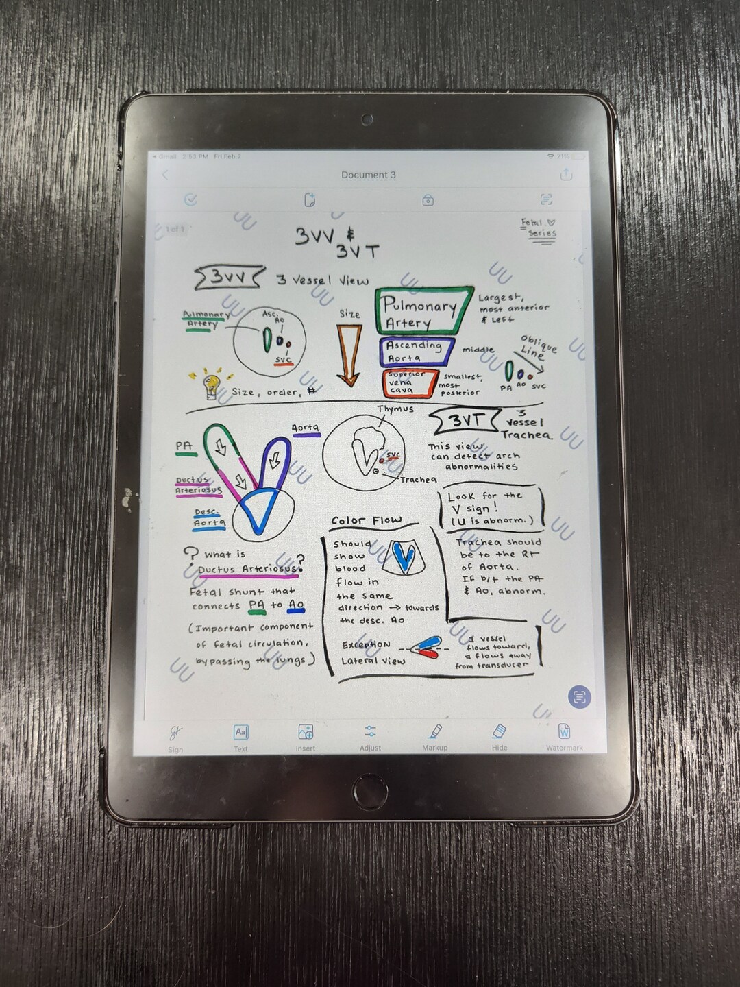 Fetal Heart Ultrasound Visual Reference: 3VV & 3VT (color) - Etsy