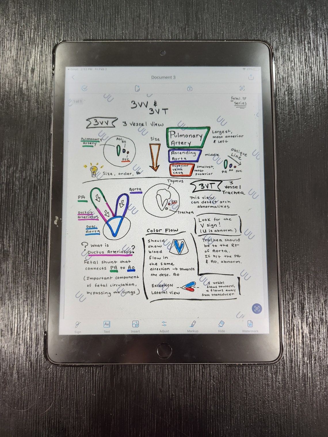 Fetal Heart Ultrasound Visual Reference: 3VV & 3VT (color) - Etsy