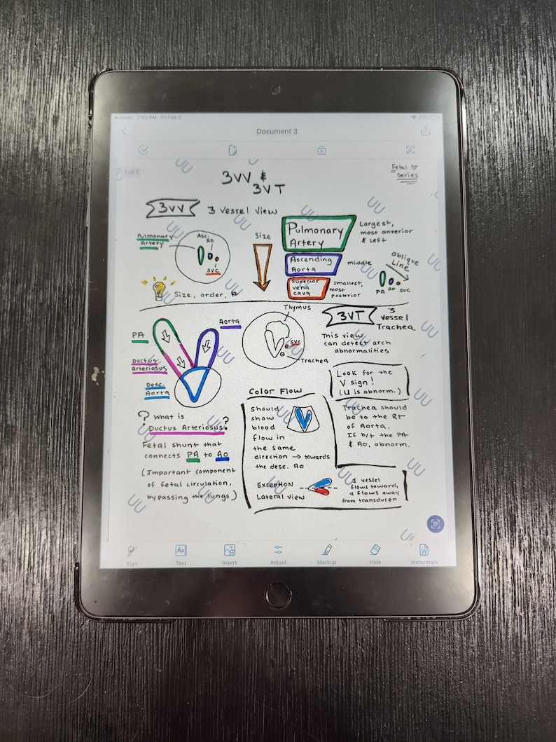 Fetal Heart Ultrasound Visual Reference: 3VV & 3VT (color) - Etsy