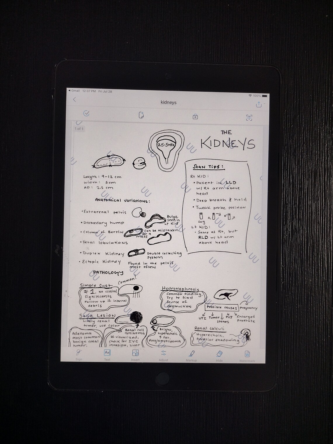 KIDNEYS Ultrasound / Sonography Scanning Visual Notes - Etsy