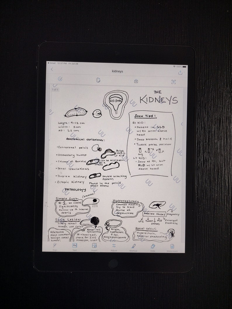 KIDNEYS Ultrasound / Sonography Scanning Visual Notes - Etsy