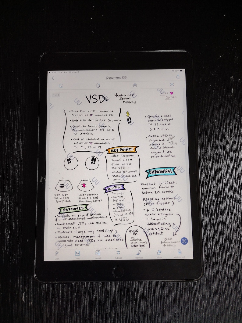 Fetal Heart Bundle: Ultrasound Visual Reference (includes Overview, 4ch ...