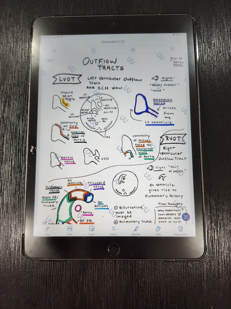 Fetal Heart Ultrasound Visual Reference: LVOT & RVOT (color) - Etsy