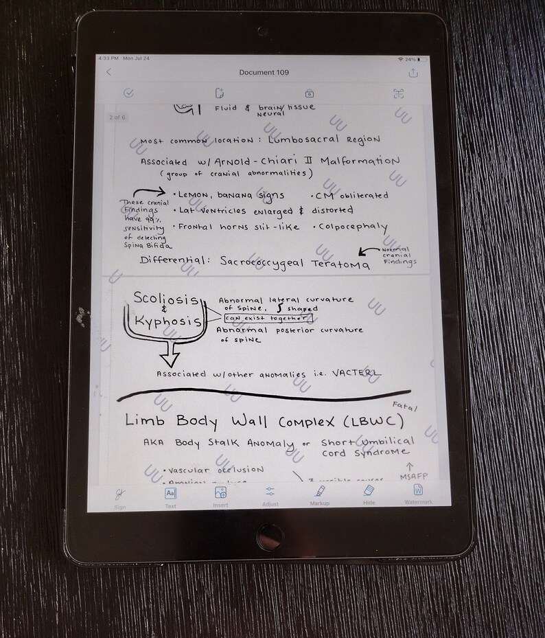 Sonography Visual Study Notes: Fetal Spine and Musculoskeletal ...