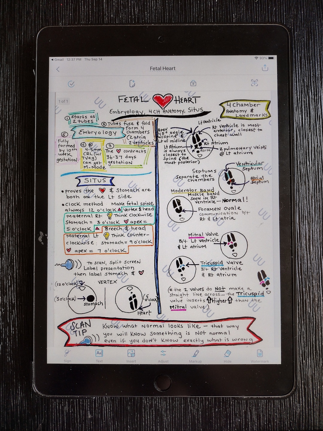 Fetal Heart Sonography / Ultrasound Visual Notes - Etsy