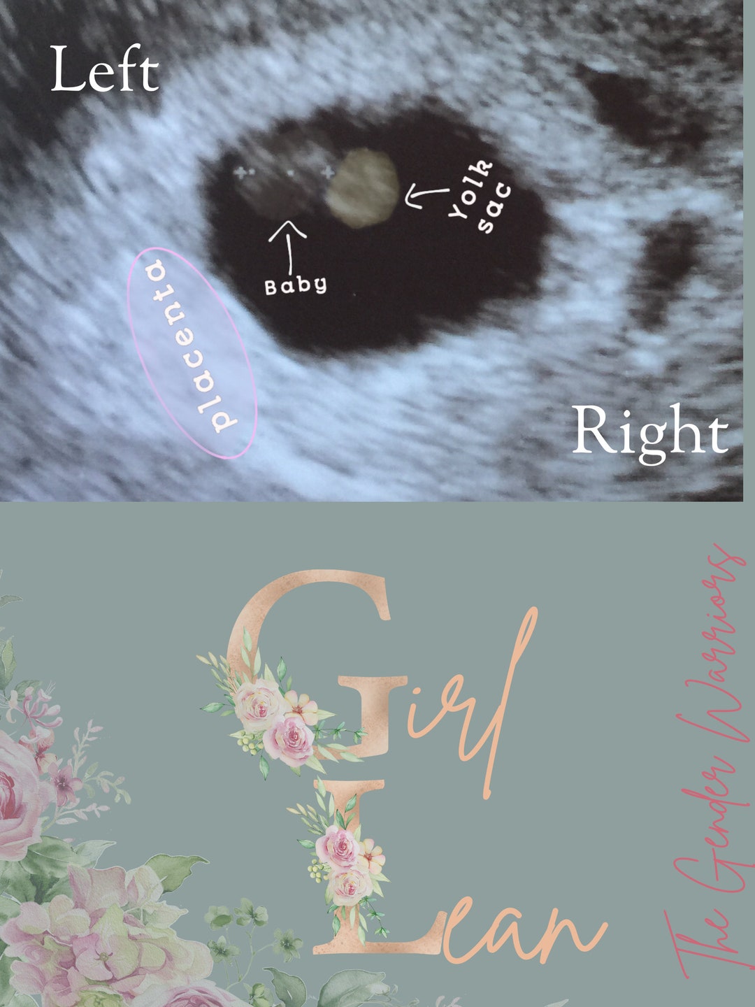 Ramzi Prediction Drawing - Etsy