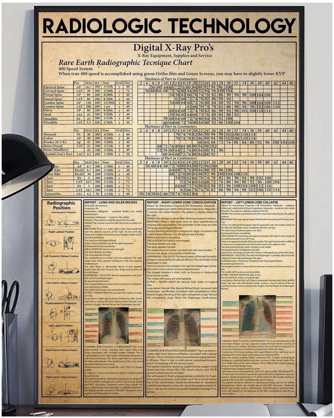 Radiology Knowledge Poster, Knowledge Poster, Diagnostic Radiology Technique Chart, Radiologic ...