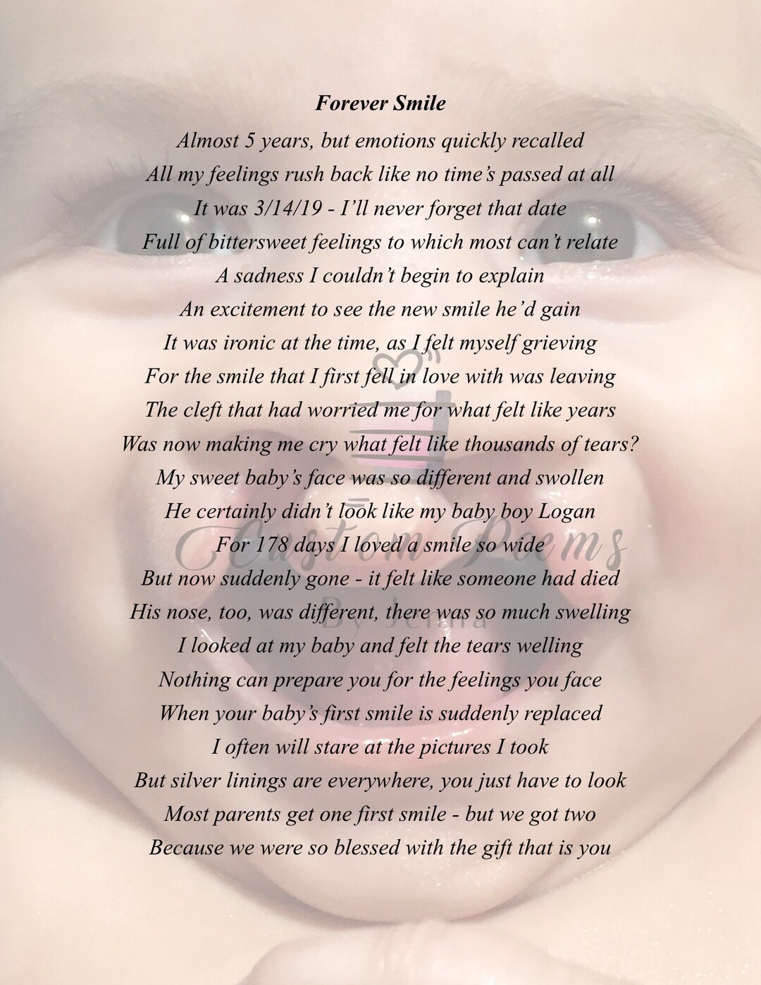 Forever Smile - A Reflection on Your Child's Cleft Smile and the ...