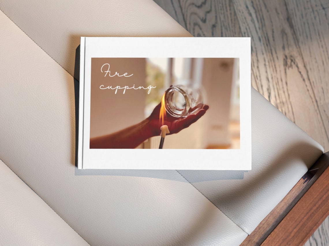 Cupping Therapy Hijama Posters Bundle 7 Posters Instant - Etsy