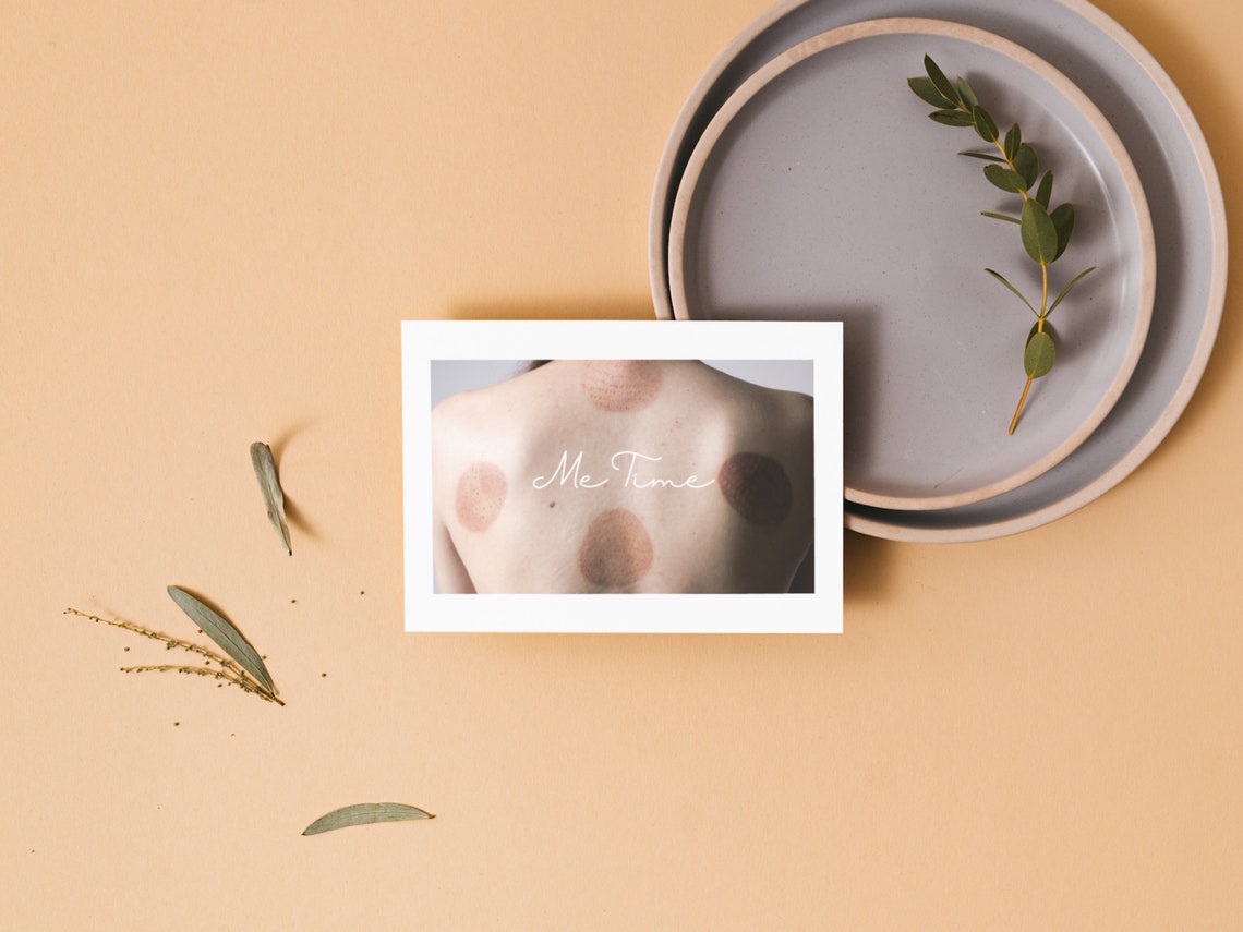 Cupping Therapy Hijama Posters Bundle 7 Posters Instant - Etsy