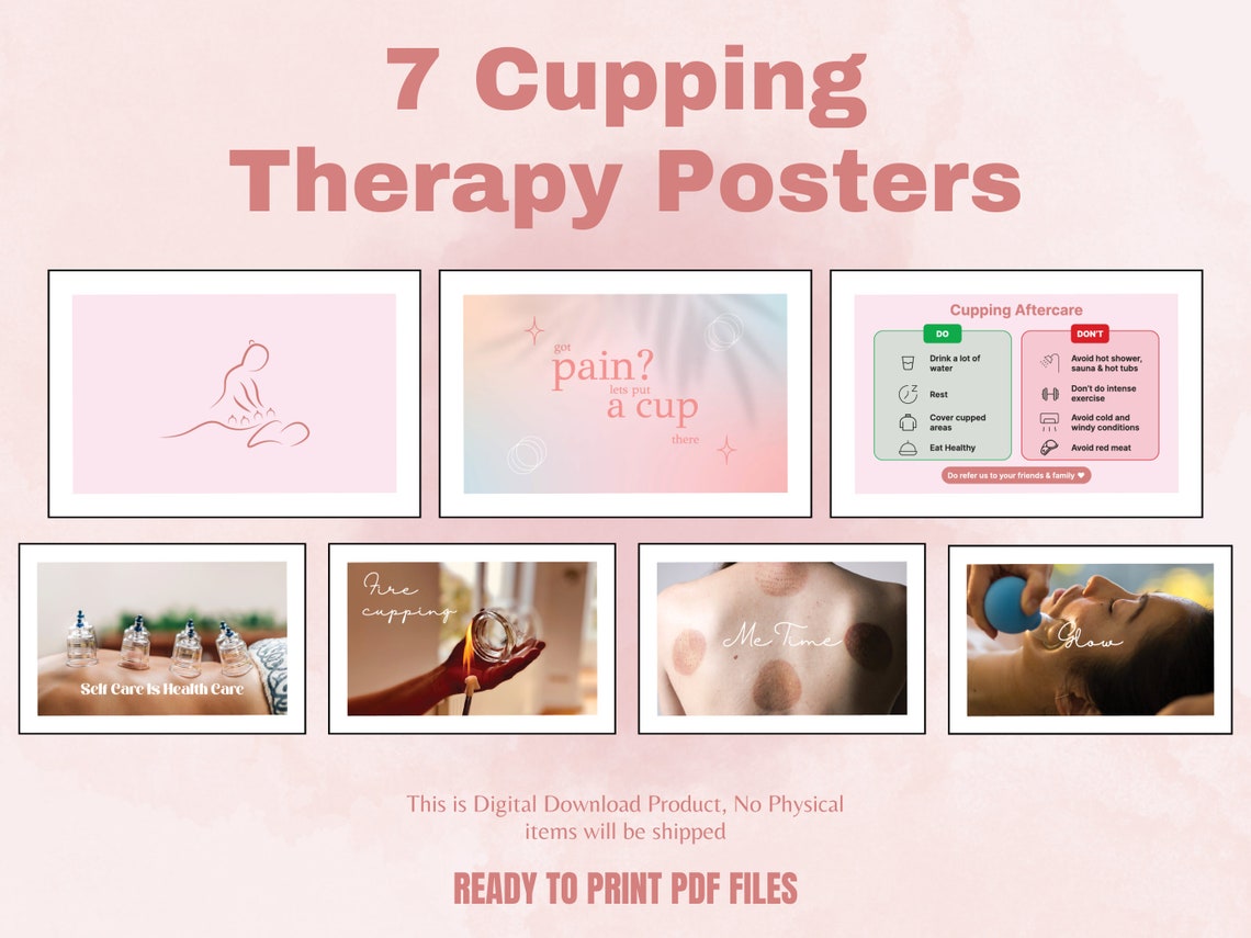 Cupping Therapy Hijama Posters Bundle 7 Posters Instant - Etsy