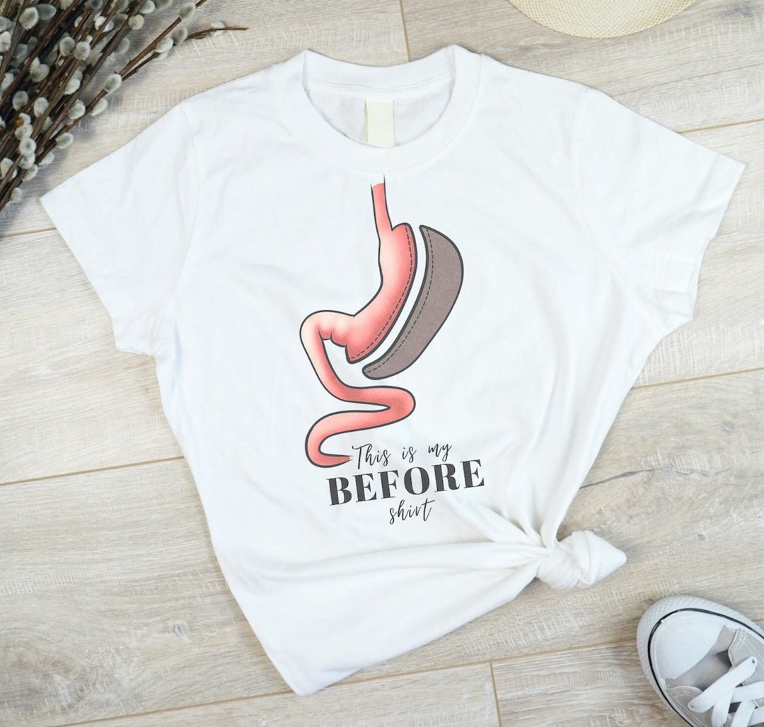 Unisex Weigh Day Before Surgery Gastric Sleeve VSG Shirt / Bariatric ...