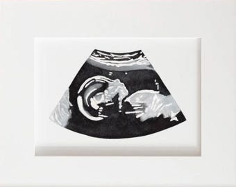 Heirloom Ultrasound or Sonogram Watercolor Painting | Baby Ultrasound ...