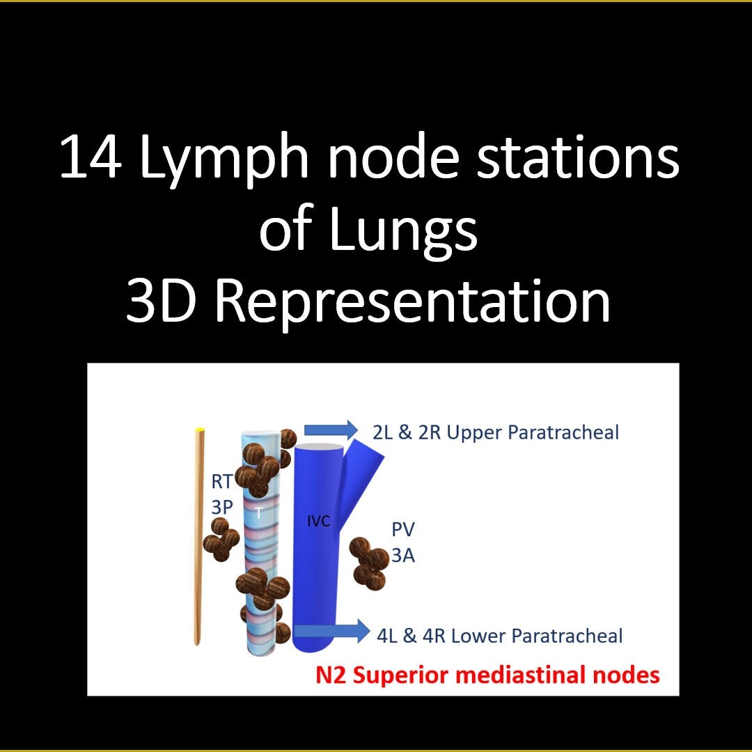 3D Model of Lungs 14 Lymph Nodes Stations on Powerpoint - Etsy