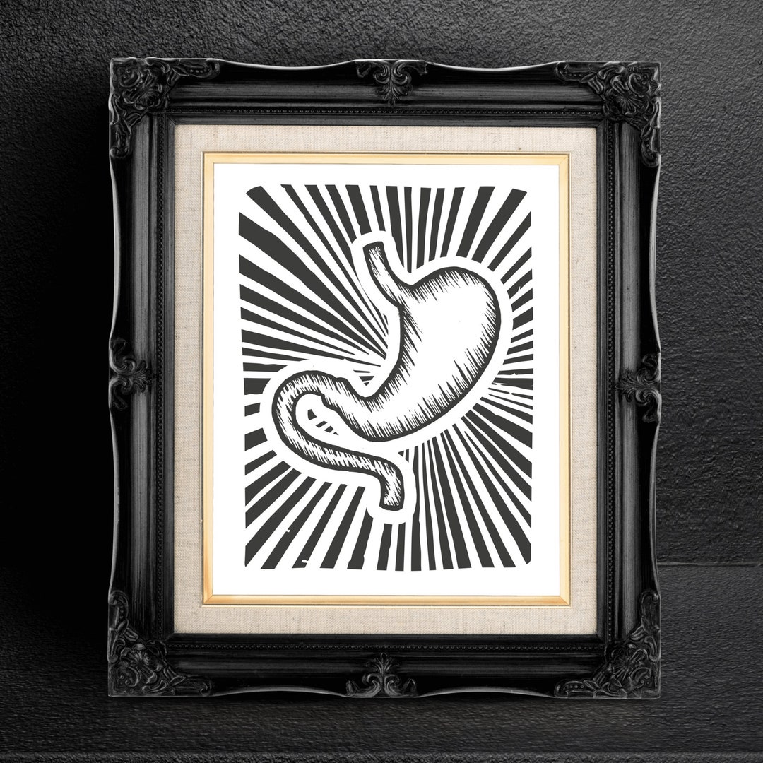 Noir Gastro: Intricate Stomach Linocut Print - Medical Decor, GI Art ...