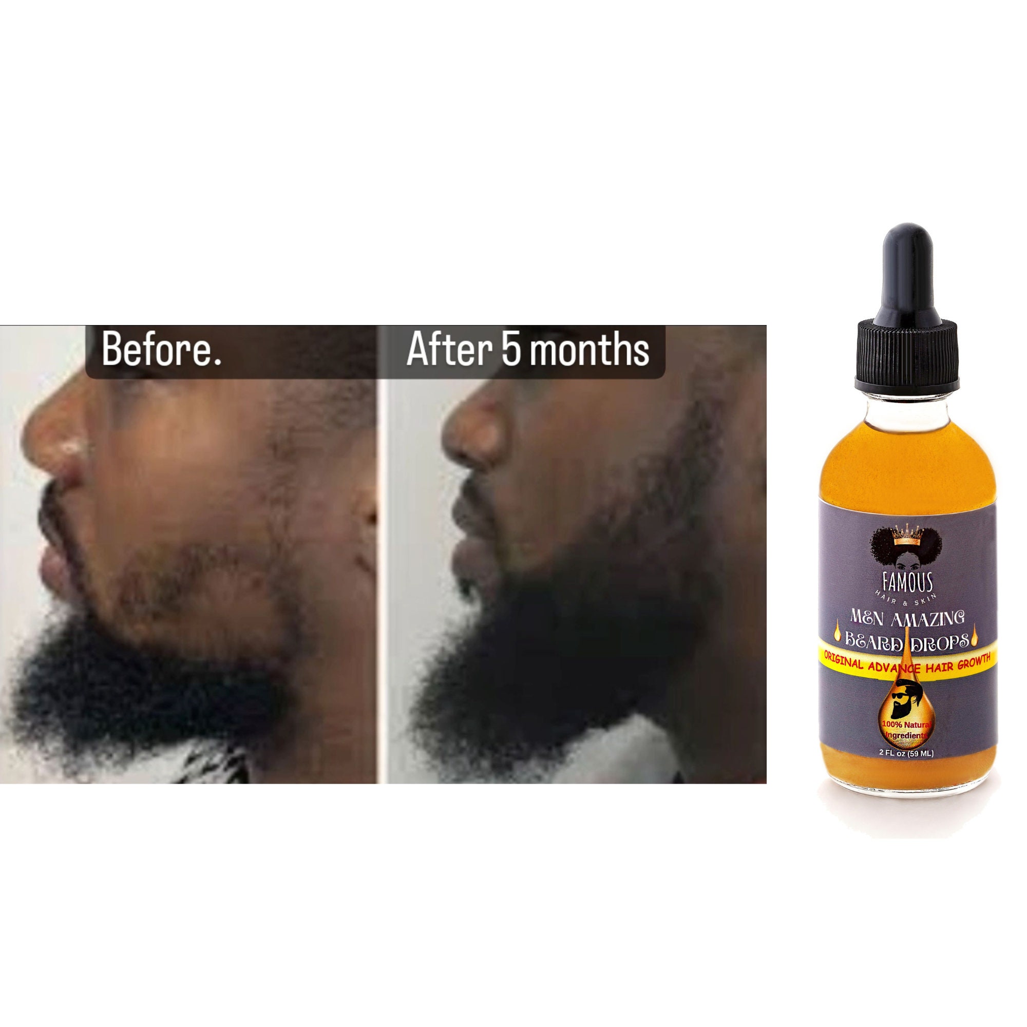 2 Oz. MEN AMAZING BEARD Drops/beard Oil/natural Beard Oil/beard Oil for ...