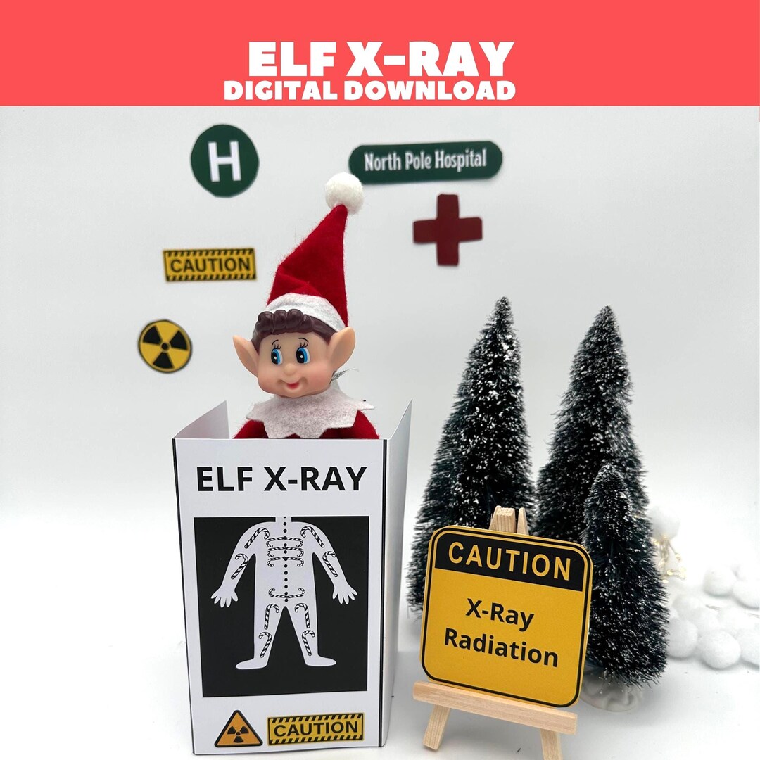 Printable Elf X-ray Props, Christmas Elf Doctor Scene, Elf Arrival ...