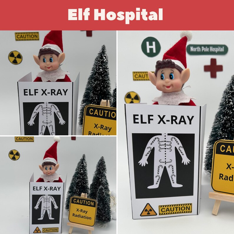 Printable Elf X-ray Props, Christmas Elf Doctor Scene, Elf Arrival ...
