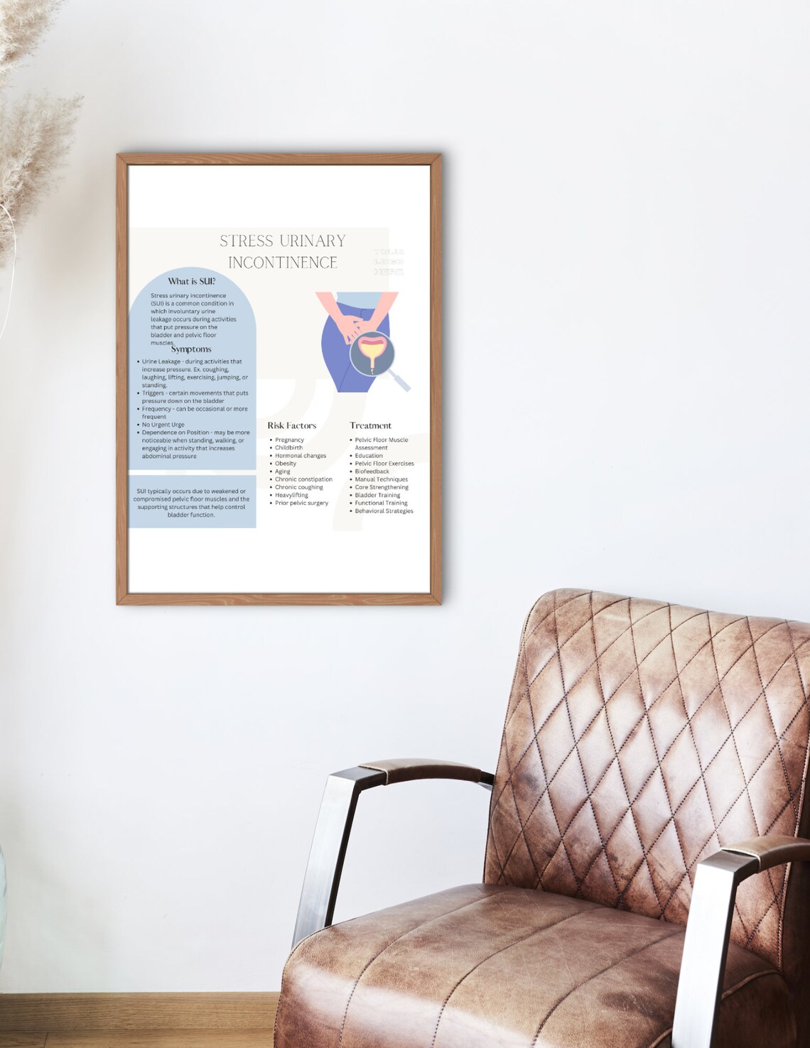 Stress Urinary Incontinence Handout Pelvic Floor Physical Therapy ...