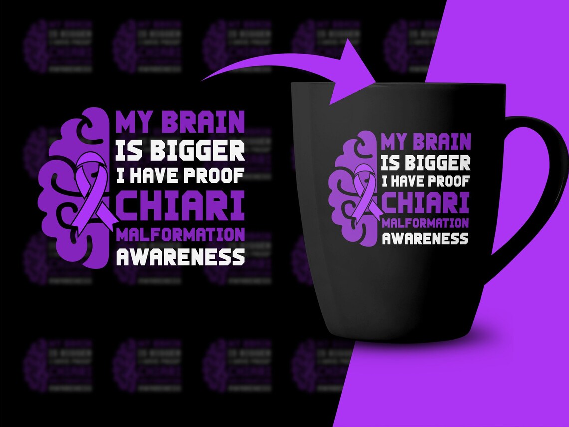 Chiari Malformation Awareness Svg Png My Brain is Bigger I - Etsy