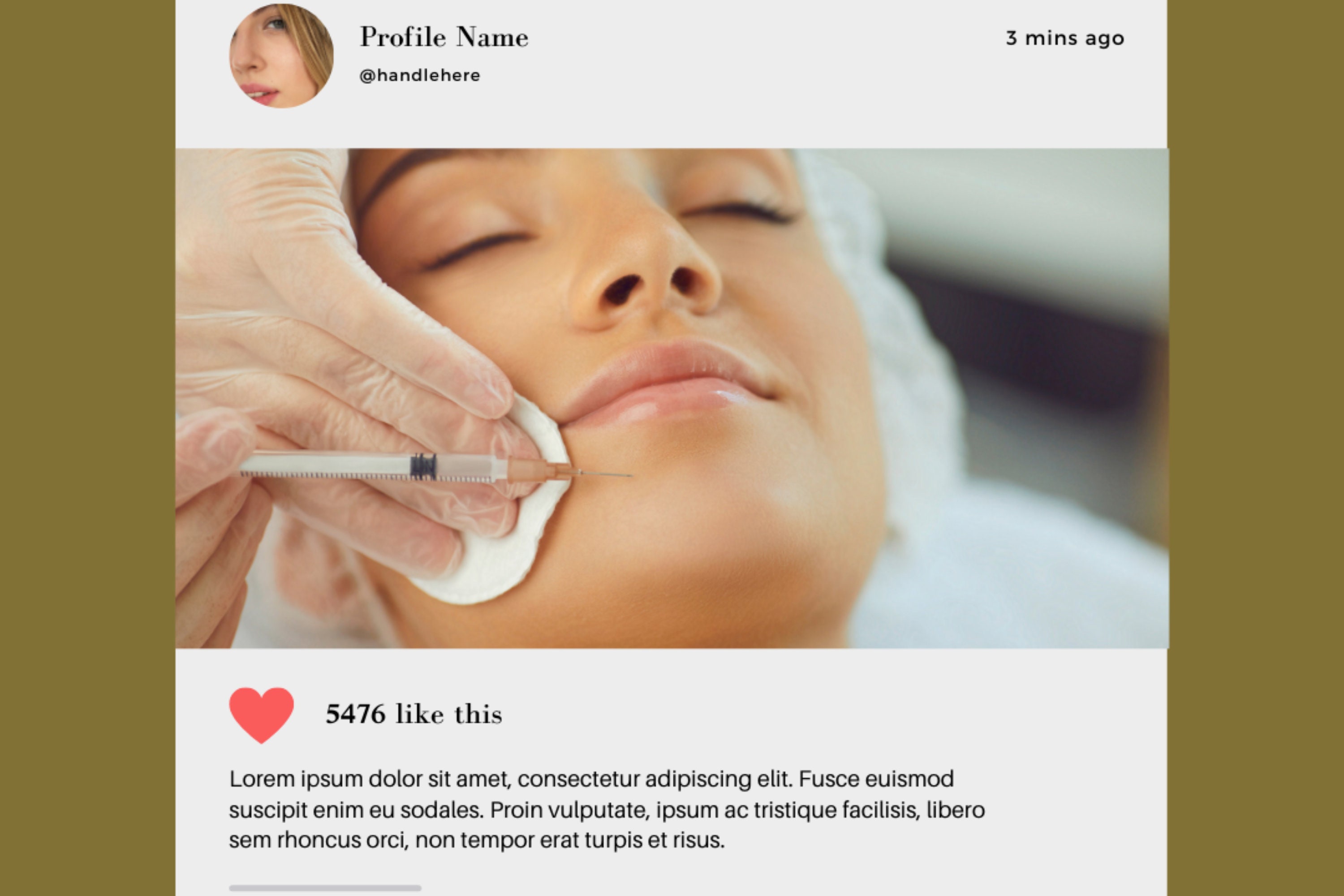 Botox and Filler Instagram Posts, Botox Instagram Post, Anti Wrinkle ...