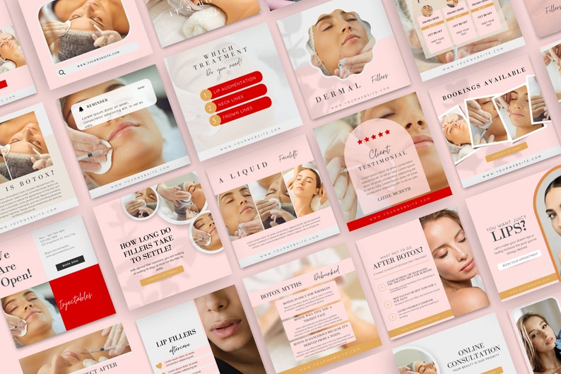 Botox and Fillers Instagram Post Template, Botox Filler Ig Posts, Botox ...