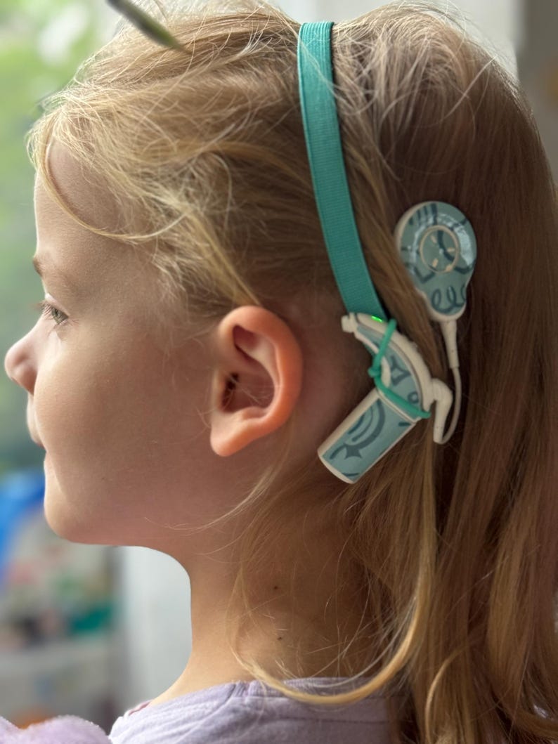 Cochlear Nucleus 7 Sticker, Turquoise Fun Skin, CI Processor Cover ...