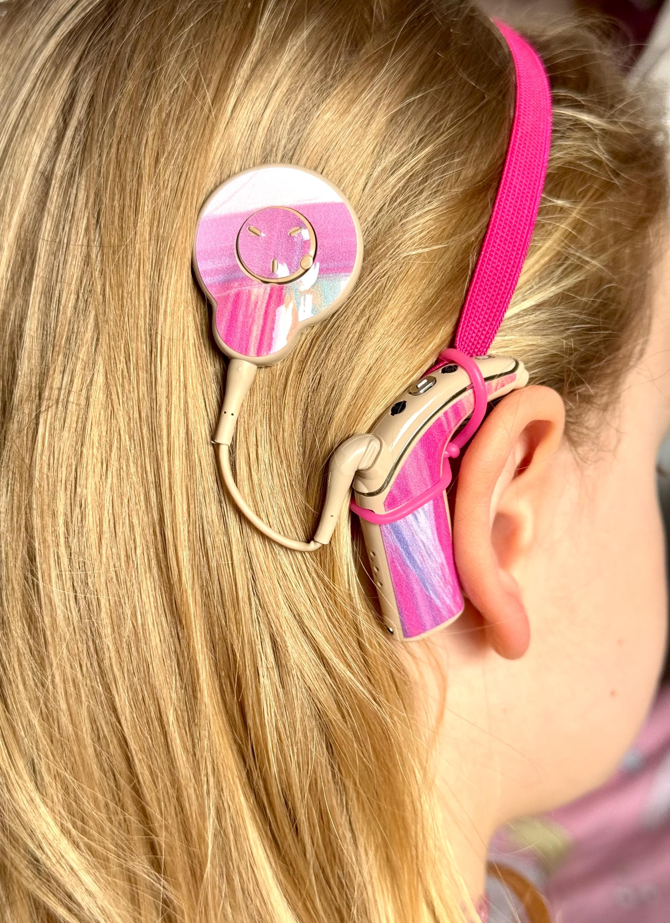 Stickers for Cochlear Implant Nucleus 7-personalize and Protect Your Device - Etsy