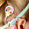 Stickers for Cochlear Implant Nucleus 7-personalize and Protect Your ...