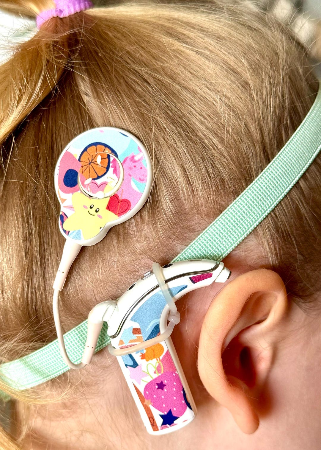 Stickers for Cochlear Implant Nucleus 7-personalize and Protect Your ...